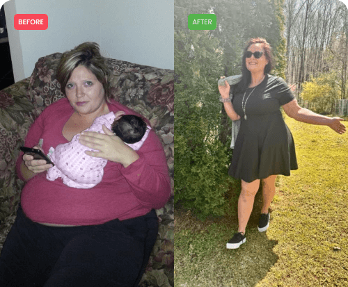 Weight loss with GLP-1 Medication - ReflexMD